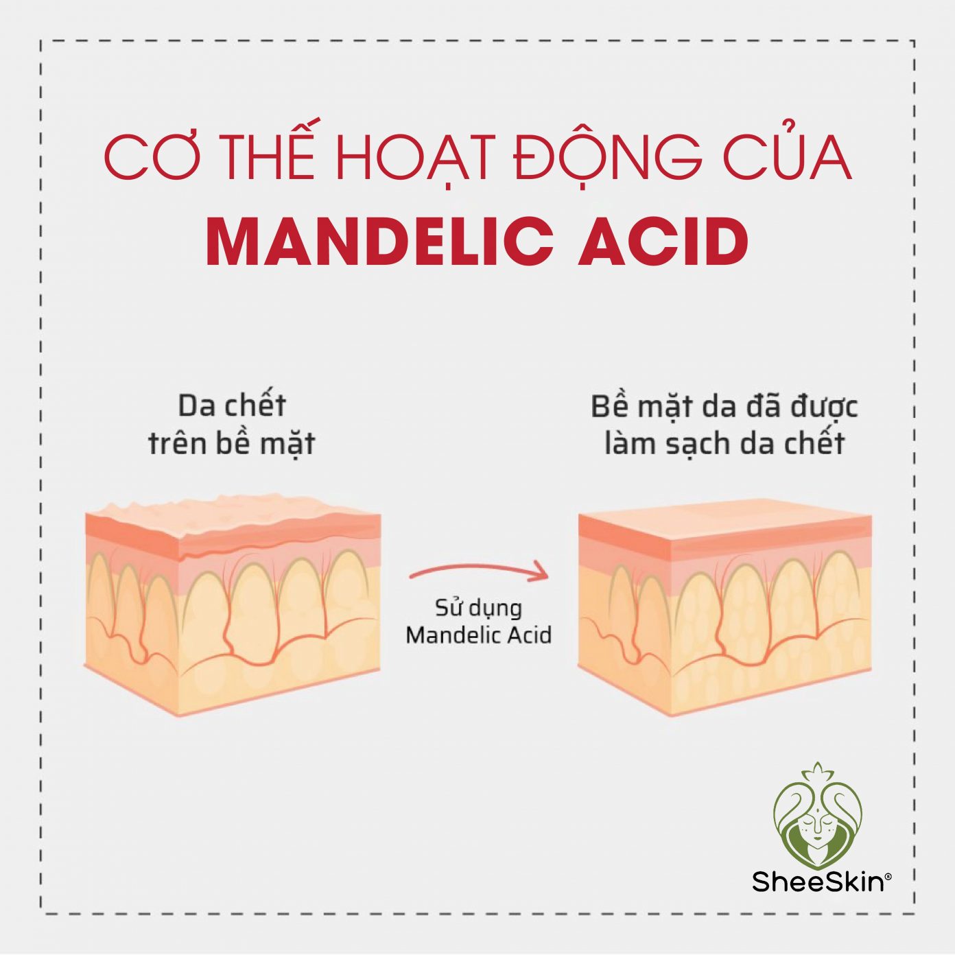 Mandelic Acid là gì? Cơ chế hoạt động Mandelic Acid trên da